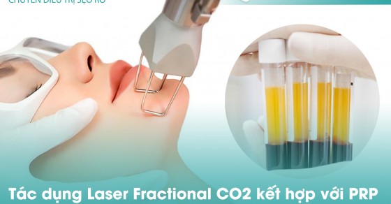 Ưu điểm Laser Fractional CO2 kết hợp với prp trong trị sẹo rỗ | Doctor Scar